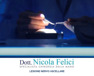 Lesione Nervo Ascellare - Dottor Nicola Felici